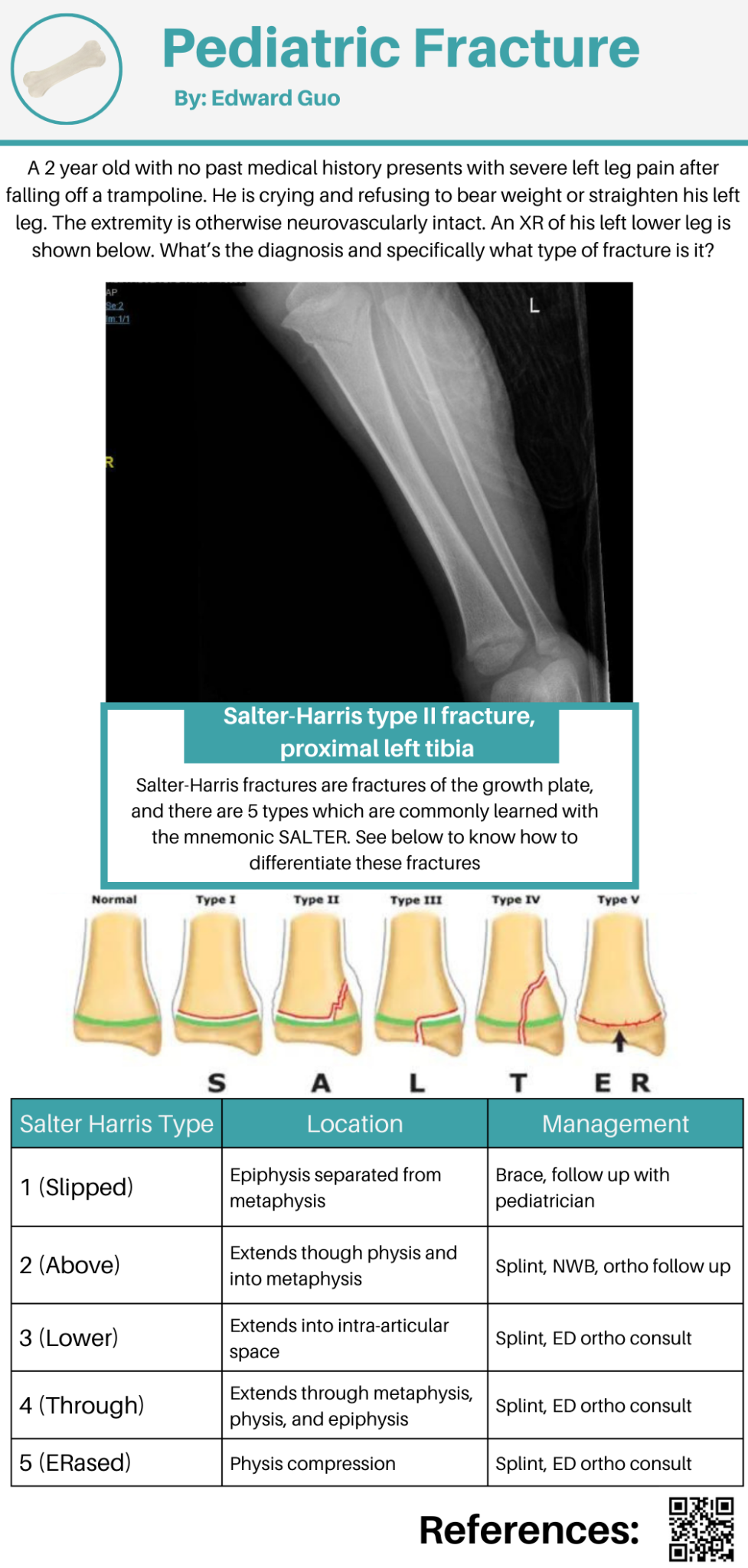 Pediatric fracture Review by Dr. Edward Guo - EM Daily