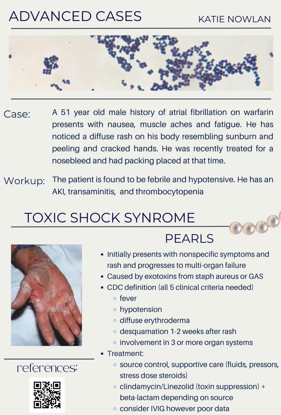 Can’t miss diagnosis: Toxic Shock Syndrome with Dr. Katie Nowlan, PGY-3 ...