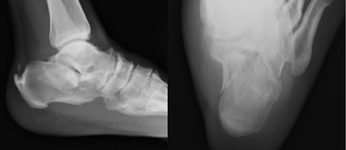 From the EMDaily Archives: What’s the Diagnosis? By Dr. Rebecca Fieles ...