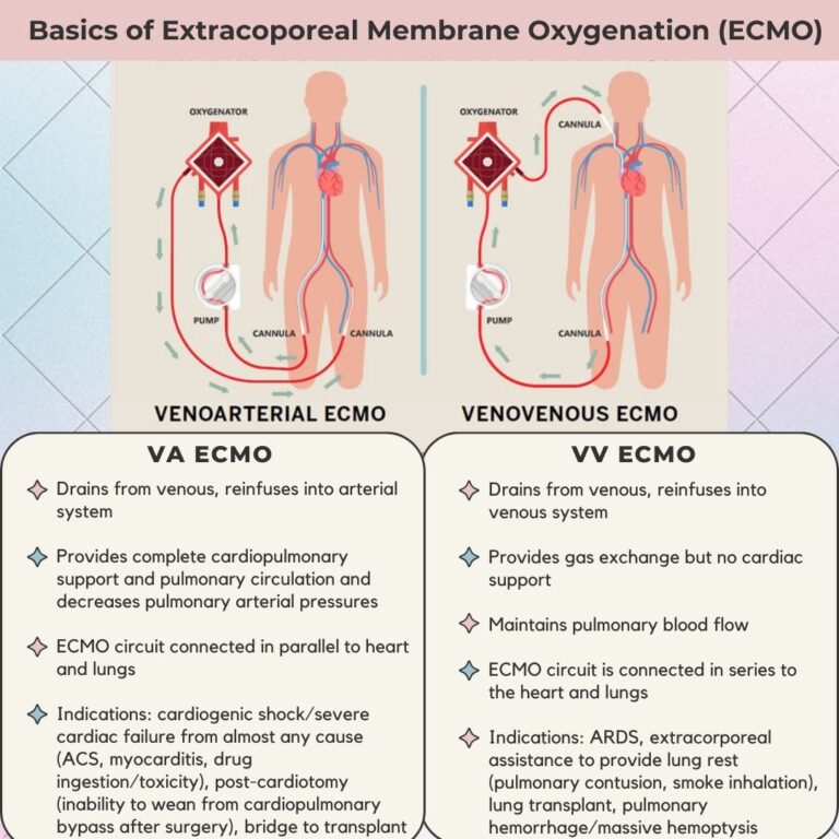 Basics of ECMO with Dr. Rebecca Fenderson - EM Daily