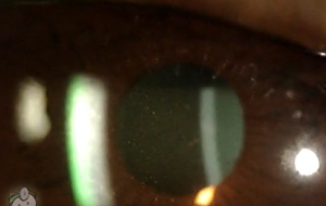 Slit Lamp Basics - EM Daily