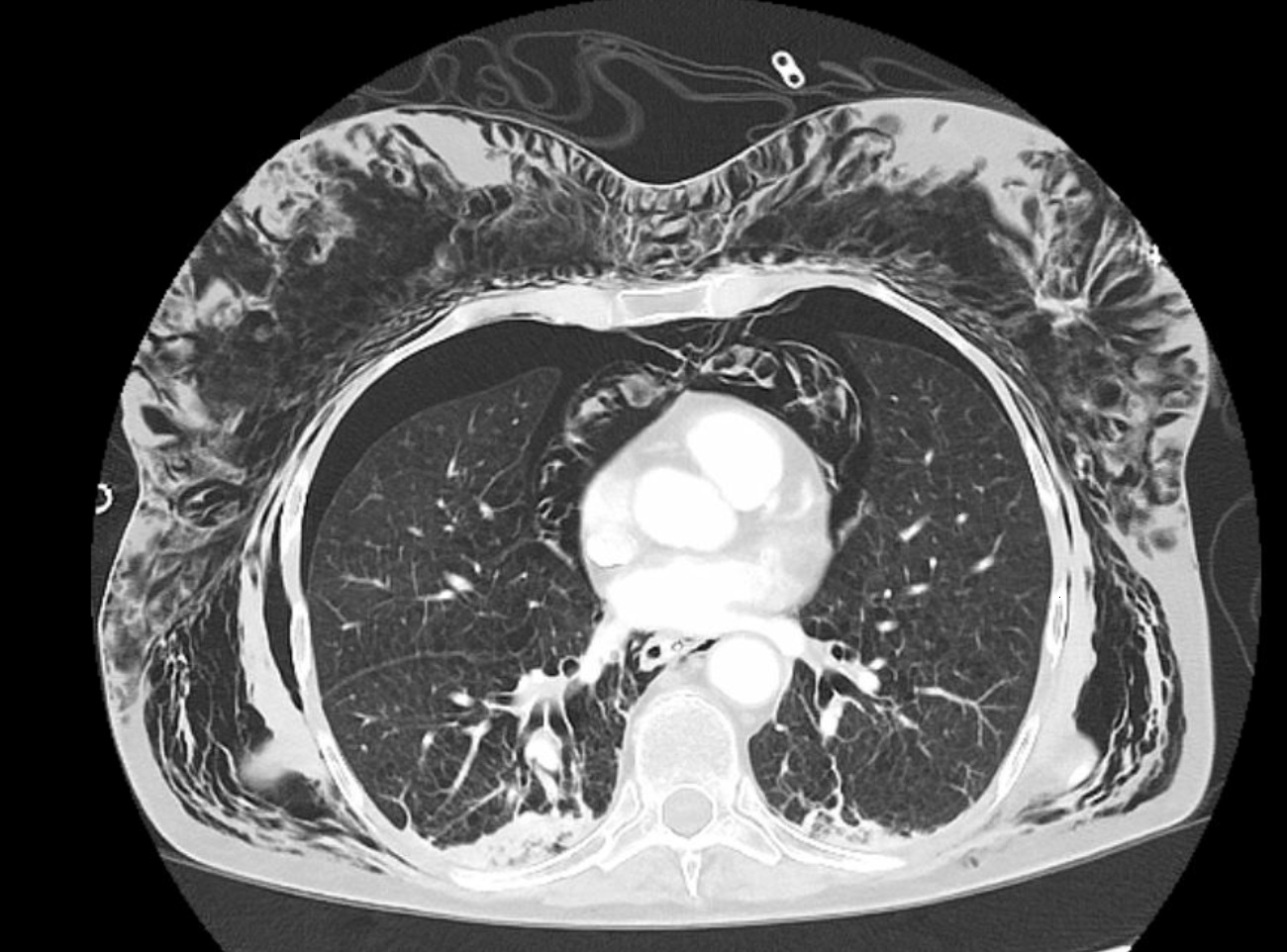 What is the Diagnosis? - EM Daily