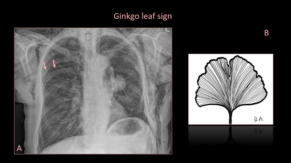 What is the Diagnosis? - EM Daily
