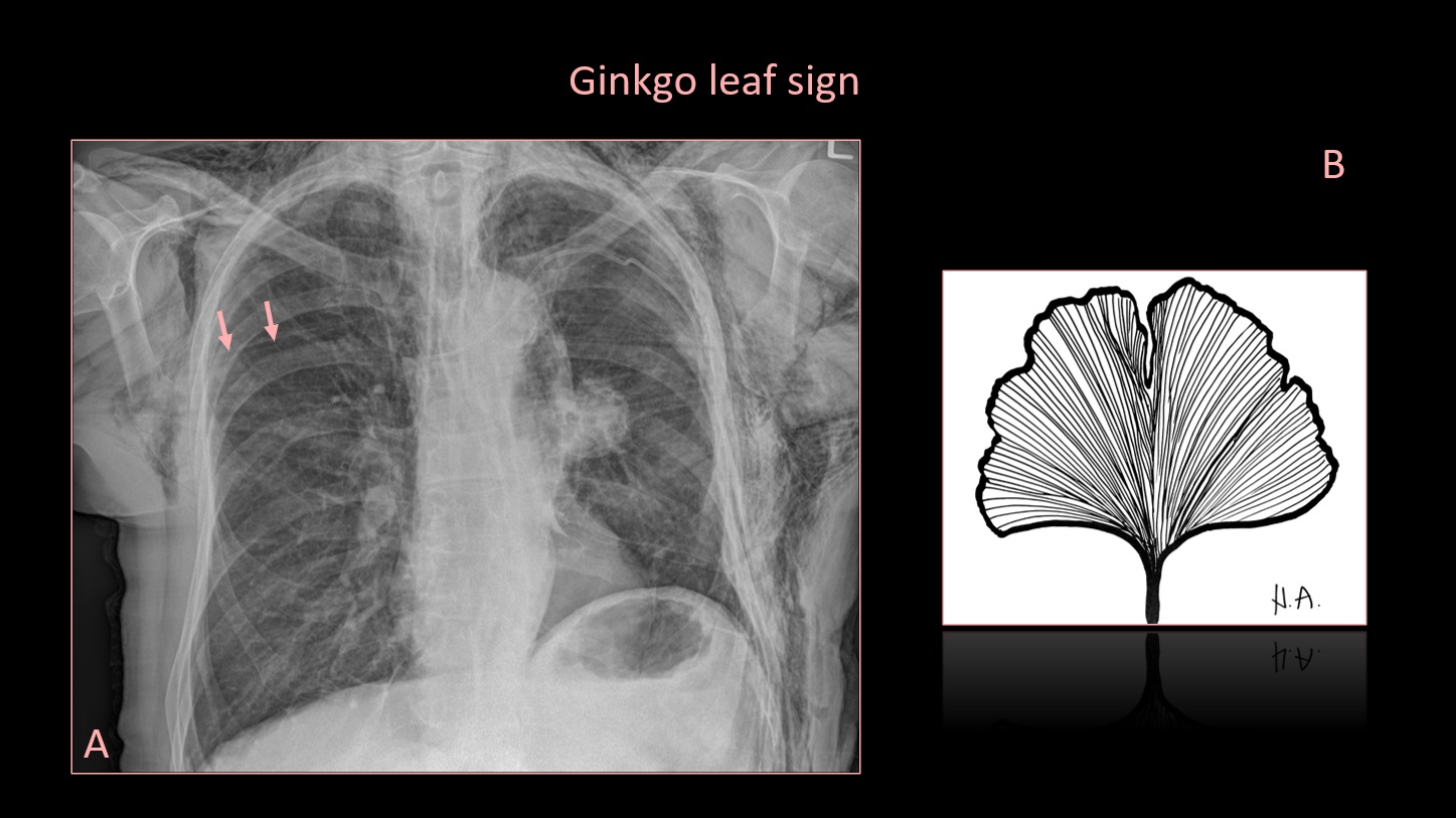 What is the Diagnosis? - EM Daily