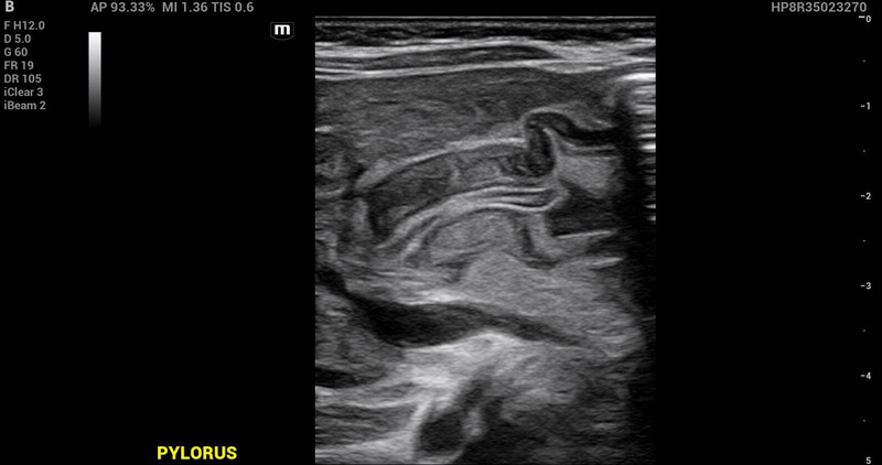 What is the Diagnosis? By Dr. Cevallos - EM Daily